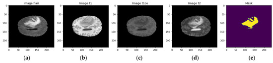 Diagnostics | Free Full-Text | Brain Tumor Segmentation Using Deep ...