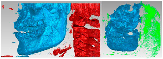 Using the Finite Element Method to Determine the Odonto-Periodontal ...