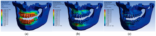 Using the Finite Element Method to Determine the Odonto-Periodontal ...