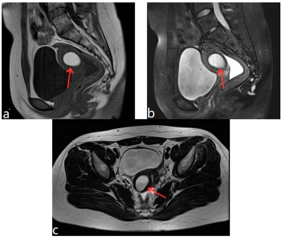 Diagnostics | Free Full-Text | High Intensity Focused Ultrasound ...