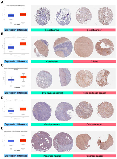 A Comprehensive Pan-Cancer Analysis Identifies CEP55 as a Potential ...