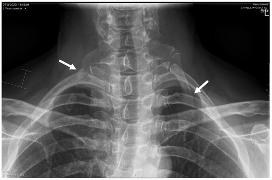 General Overview and Diagnostic (Imaging) Techniques for Neurogenic ...