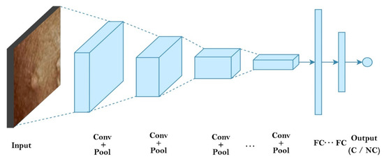 Diagnostics | Free Full-Text | Classification of Monkeypox Images Using LIME-Enabled ...