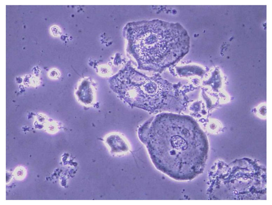 Sexually Transmitted Diseases—An Update and Overview of Current Research