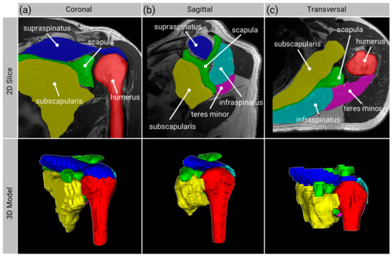 Deep-Learning-Based Segmentation of the Shoulder from MRI with Inference Accuracy Prediction