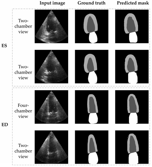 Segmentation of Anatomical Structures of the Left Heart from ...