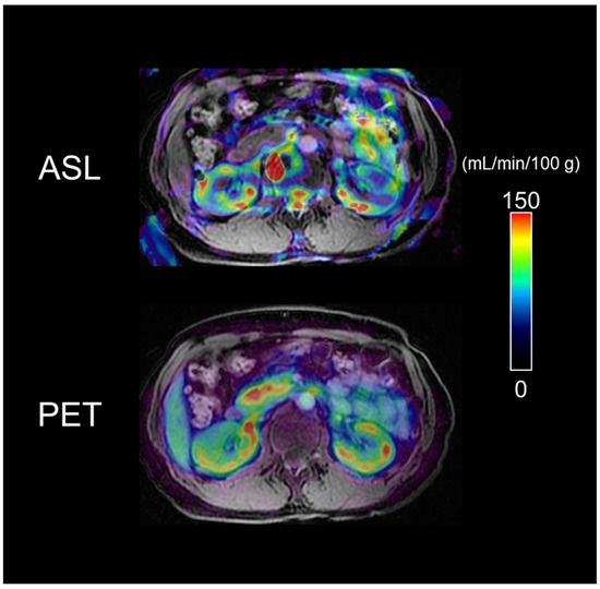 Diagnostics | Free Full-Text | Feasibility of Renal Blood Flow ...