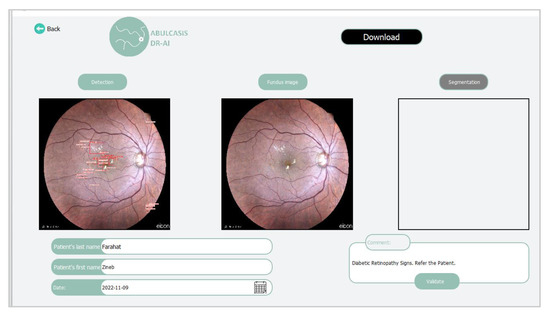 Application of Deep Learning Methods in a Moroccan Ophthalmic Center ...