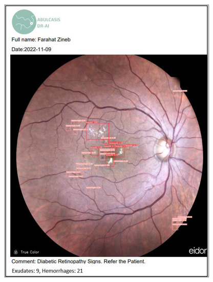 Application of Deep Learning Methods in a Moroccan Ophthalmic Center ...