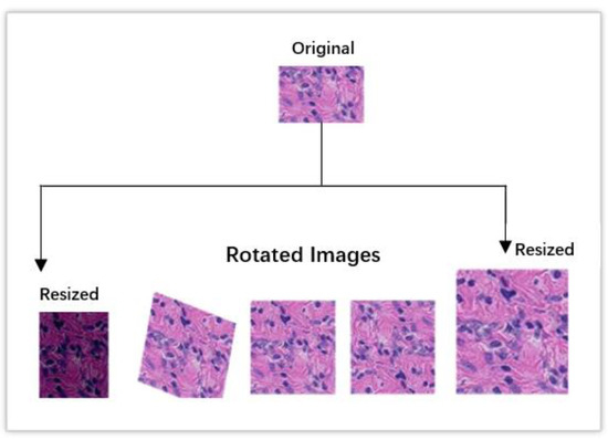 Detection and Classification of Histopathological Breast Images Using a ...
