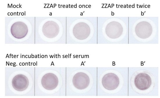 Diagnostics | Free Full-Text | Evaluation of Platelet Alloimmunization ...
