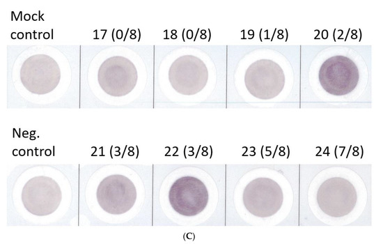 Diagnostics | Free Full-Text | Evaluation of Platelet Alloimmunization ...