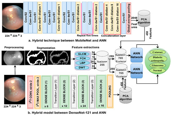 Automatic Classification of Colour Fundus Images for Prediction Eye Disease Types Based on ...