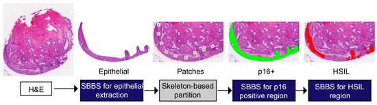 Deep Learning-Based Recognition of Cervical Squamous Interepithelial ...