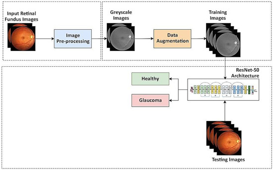 Automatic Diagnosis of Glaucoma from Retinal Images Using Deep Learning Approach