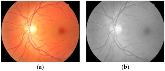 Automatic Diagnosis of Glaucoma from Retinal Images Using Deep Learning Approach