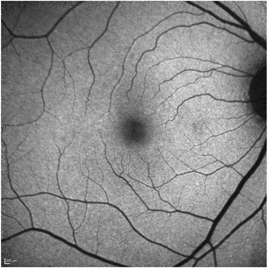 Diagnostics | Free Full-Text | Review of Retinal Imaging Modalities for ...
