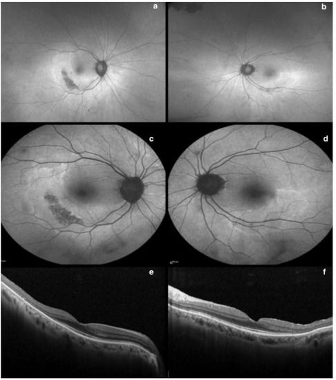Diagnostics | Free Full-Text | Review of Retinal Imaging Modalities for ...