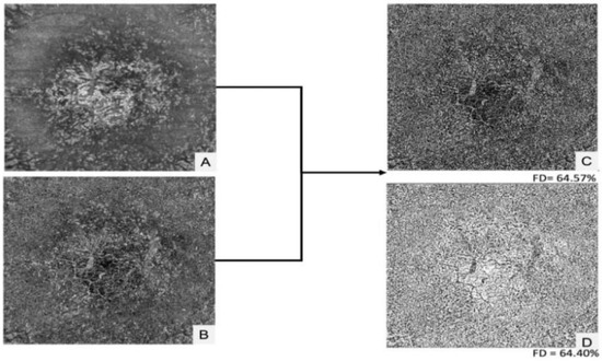 Diagnostics | Free Full-Text | Review of Retinal Imaging Modalities for ...