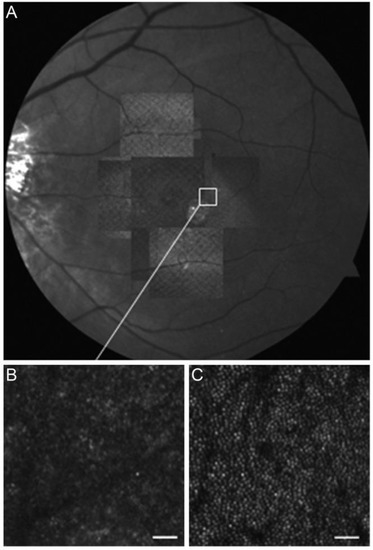 Diagnostics | Free Full-Text | Review of Retinal Imaging Modalities for ...