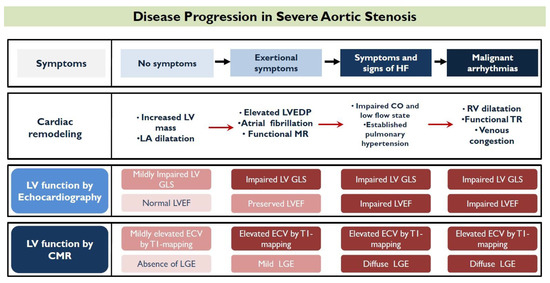 Shifting from Left Ventricular Ejection Fraction to Strain Imaging in Aortic Stenosis