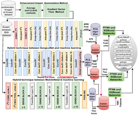Diagnostics | Free Full-Text | Hybrid Models for Endoscopy Image ...