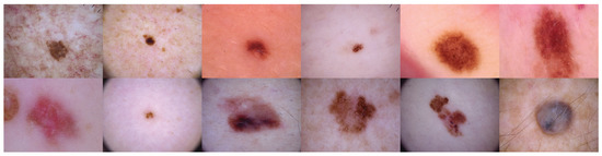 Serial Dependence in Dermatological Judgments