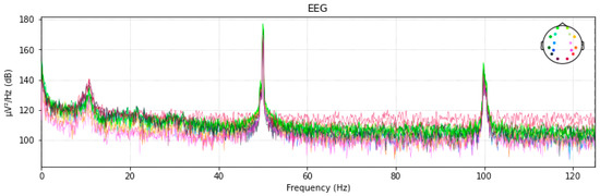 Electroencephalography-Based Depression Detection Using Multiple ...