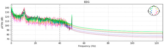 Electroencephalography-Based Depression Detection Using Multiple ...