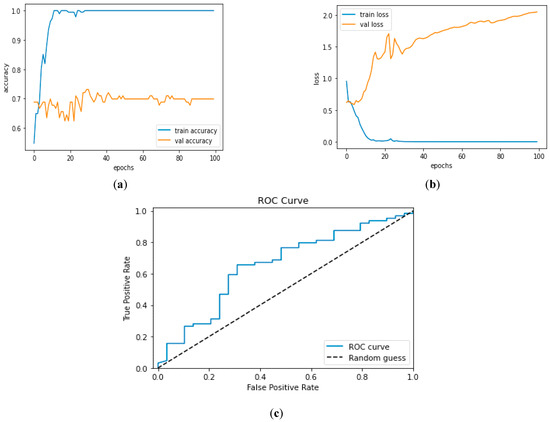 Electroencephalography-Based Depression Detection Using Multiple ...