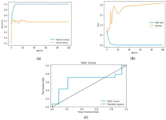 Electroencephalography-Based Depression Detection Using Multiple Machine Learning Techniques