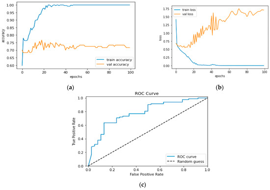 Electroencephalography-Based Depression Detection Using Multiple ...