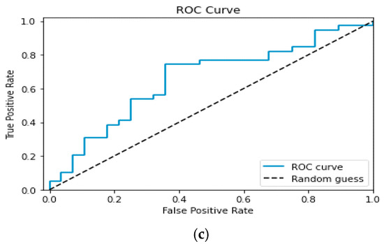Electroencephalography-Based Depression Detection Using Multiple ...