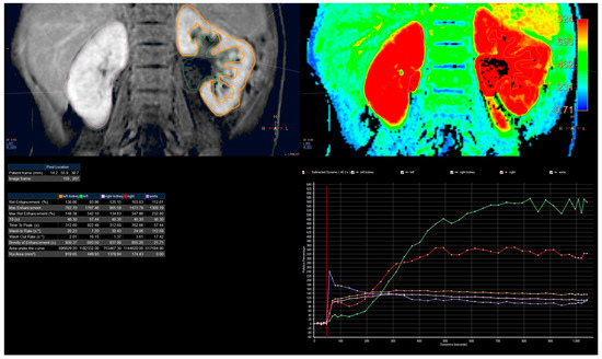 Diagnostics | Free Full-Text | Functional Magnetic Resonance Urography ...