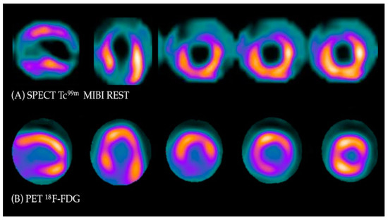 Diagnostics | Free Full-Text | The Role of Positron Emission Tomography ...