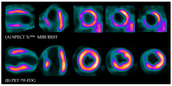 The Role of Positron Emission Tomography in Advancing the Understanding ...