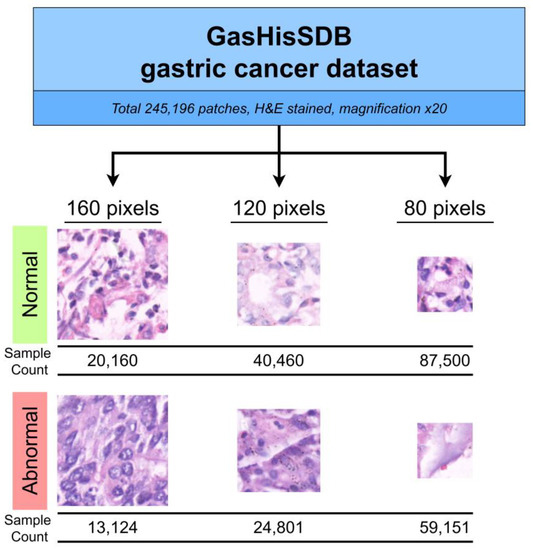 Diagnostics | Free Full-Text | Histopathological Gastric Cancer ...