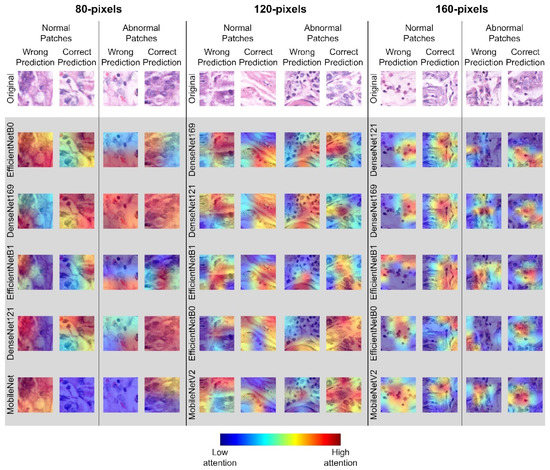 Diagnostics | Free Full-Text | Histopathological Gastric Cancer ...