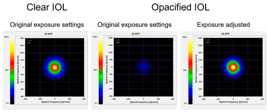 Imaging Function and Relative Light Transmission of Explanted Opacified ...