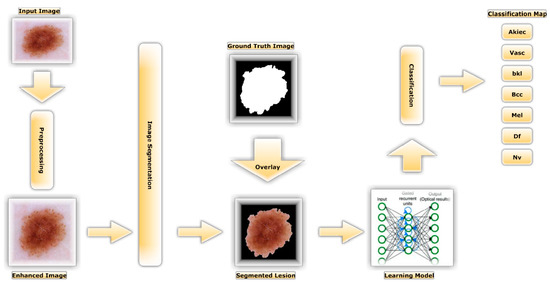 Diagnosing Melanomas in Dermoscopy Images Using Deep Learning