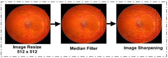 A Hybrid Technique for Diabetic Retinopathy Detection Based on Ensemble ...