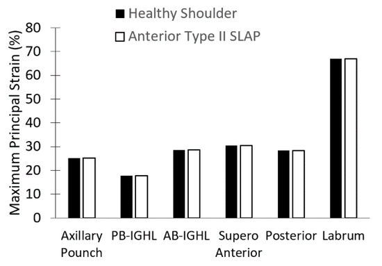 Image-Based Numerical Analysis for Isolated Type II SLAP Lesions in ...