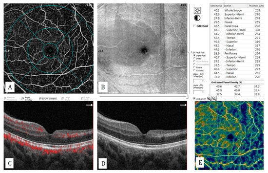 Diagnostics | Free Full-Text | Clinical Use of Optical Coherence ...