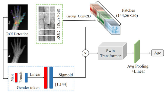 Diagnostics | Free Full-Text | Automated Skeletal Bone Age Assessment ...
