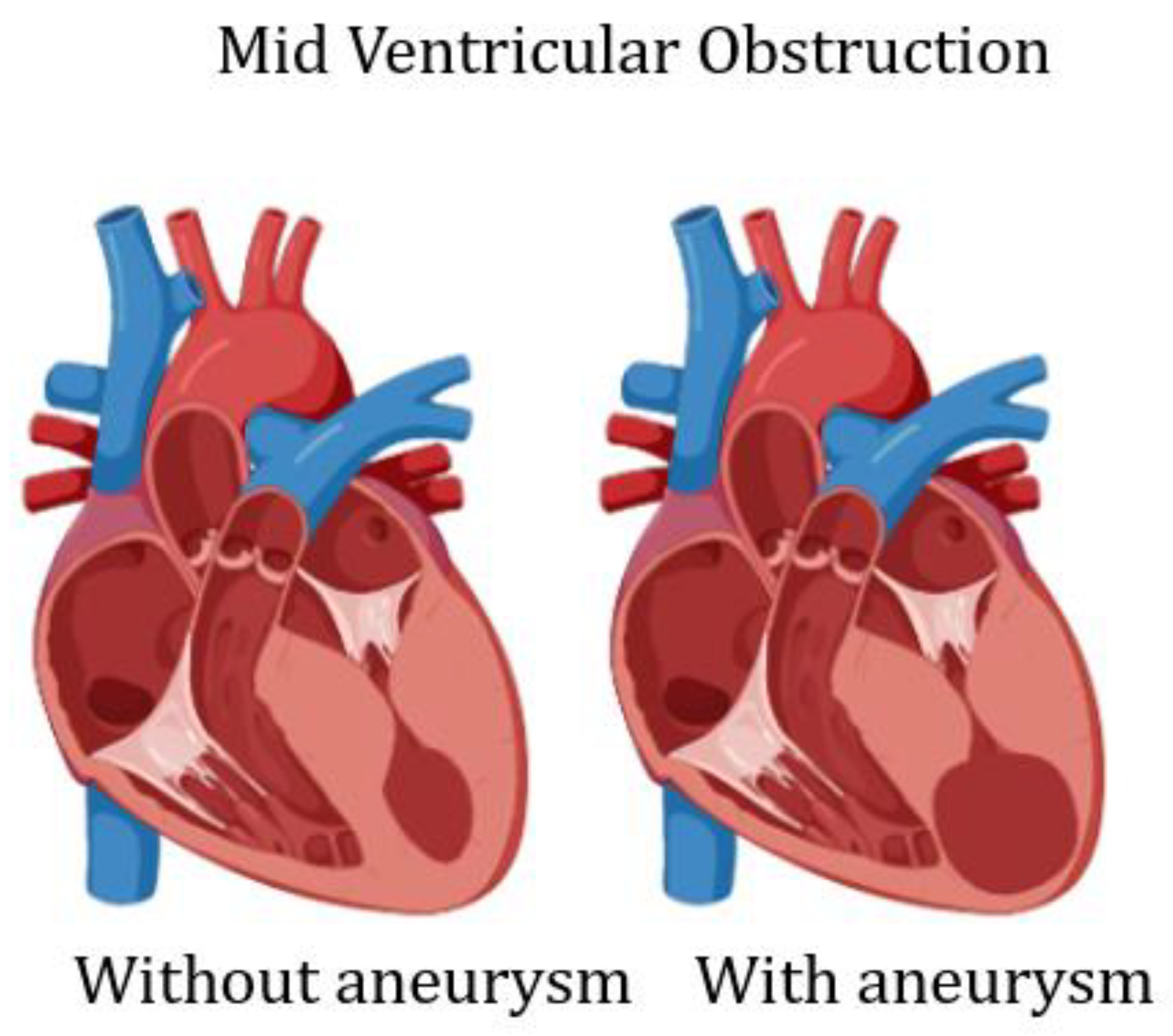 Diagnostics | Free Full-Text | Diagnosis and Clinical Implication of Left Ventricular Aneurysm ...