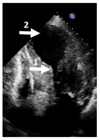 Diagnostics | Free Full-Text | Diagnosis and Clinical Implication of ...