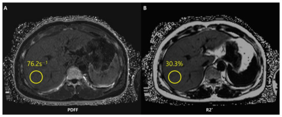 Diagnostics | Free Full-Text | Non-Invasive Imaging Methods to Evaluate ...