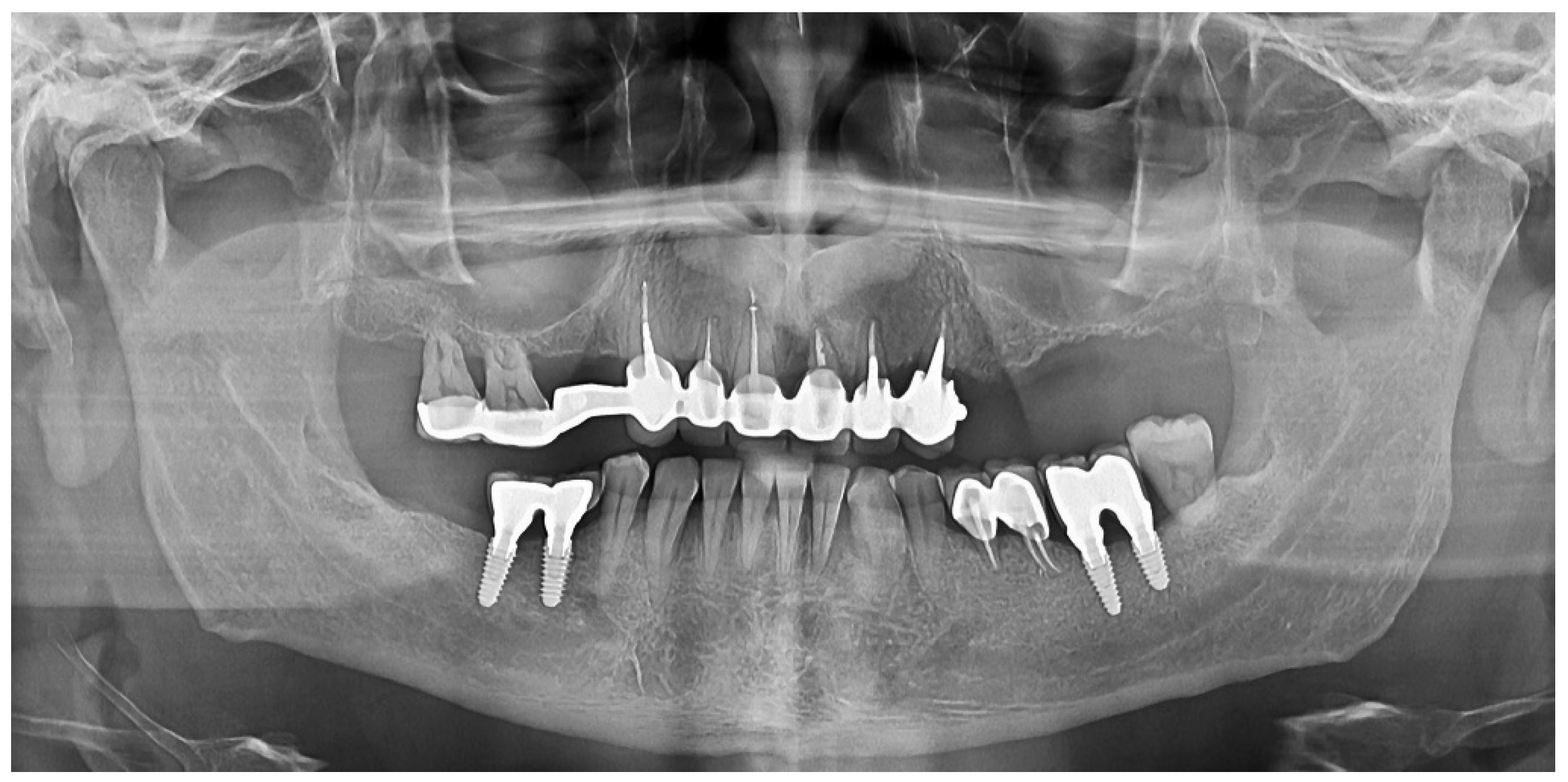 Clinical and Radiological Characterization of the Long-Term Association ...