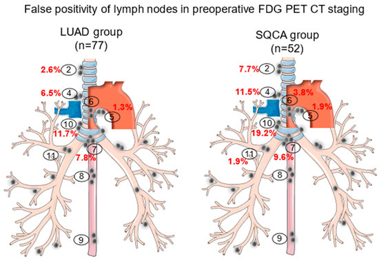 Diagnostics | Free Full-Text | Histology of the Primary Tumor ...