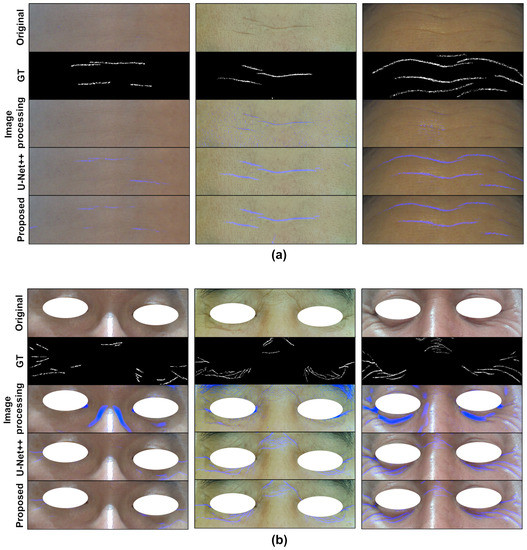 Deep-Learning-Based Morphological Feature Segmentation for Facial Skin Image Analysis